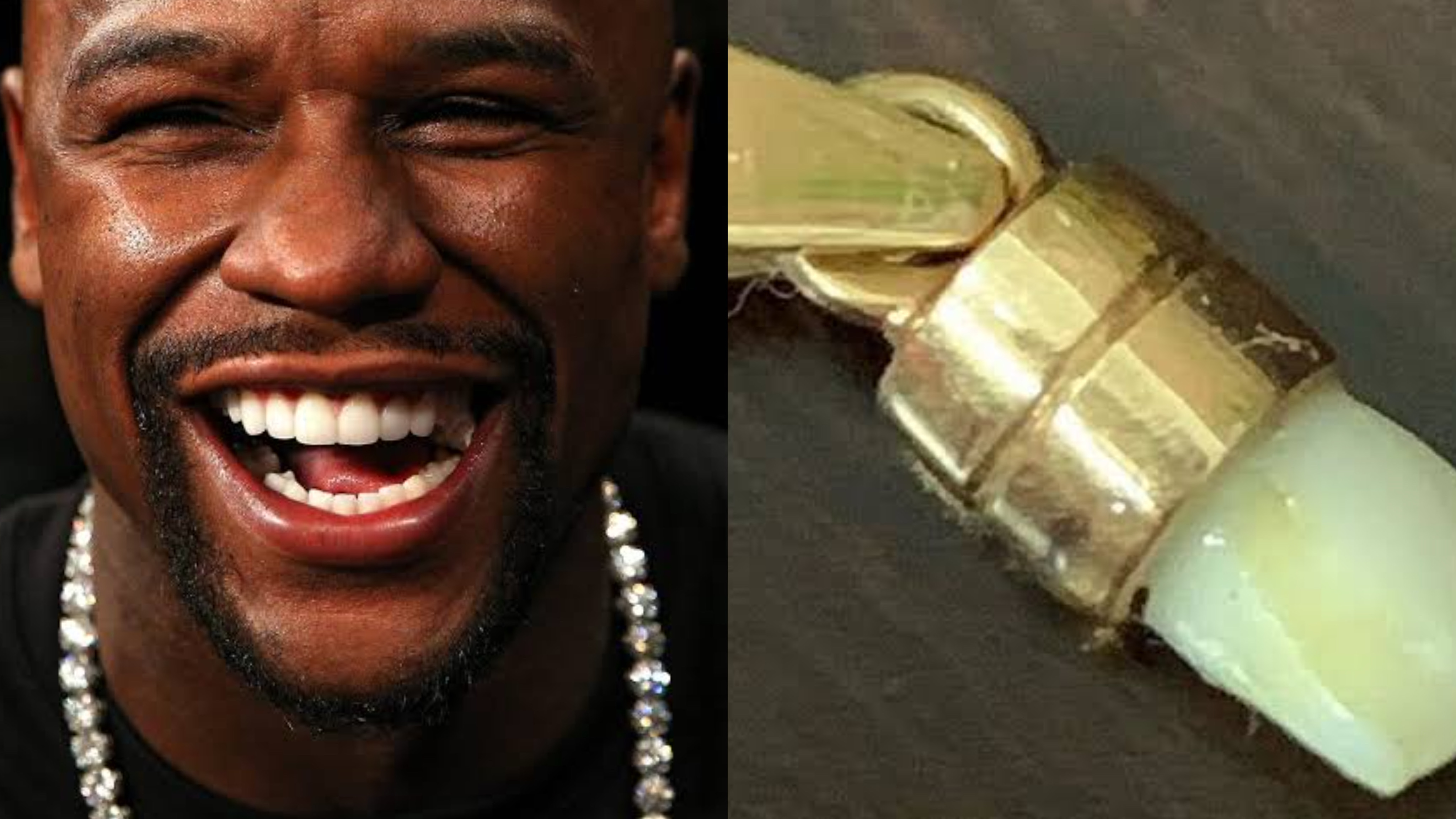 Floyd Mayweather's Tooth Once Got Put Into a Pendant By The World ...